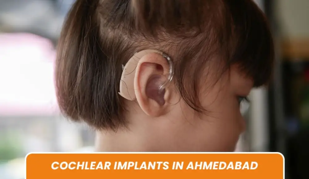 Cochlear Implants in Ahmedabad | How They Work