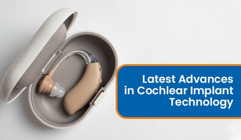 Latest Advances in Cochlear Implant Technology at Aashwi ENT