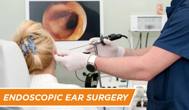 Endoscopic Ear Surgery Explained: Benefits, Safety & Recovery